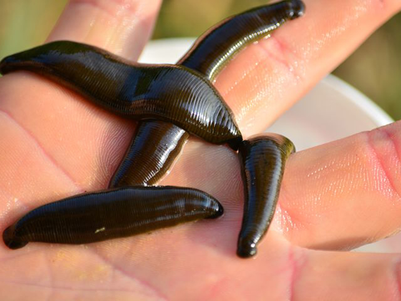 Terapi Lintah Ampuh Obati Berbagai Penyakit, Khasiatnya...